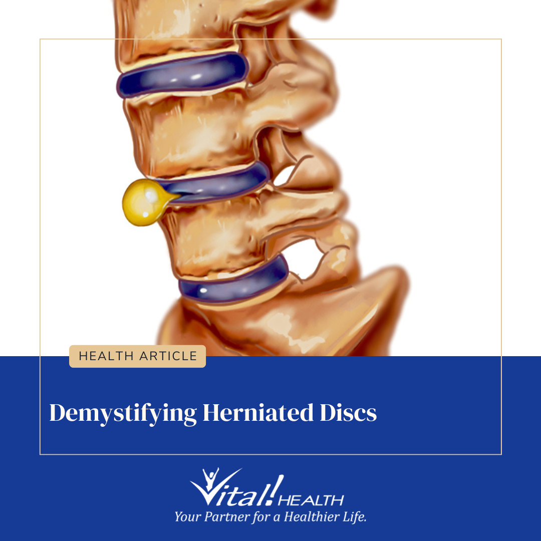 Demystifying Herniated Discs – Vital Health