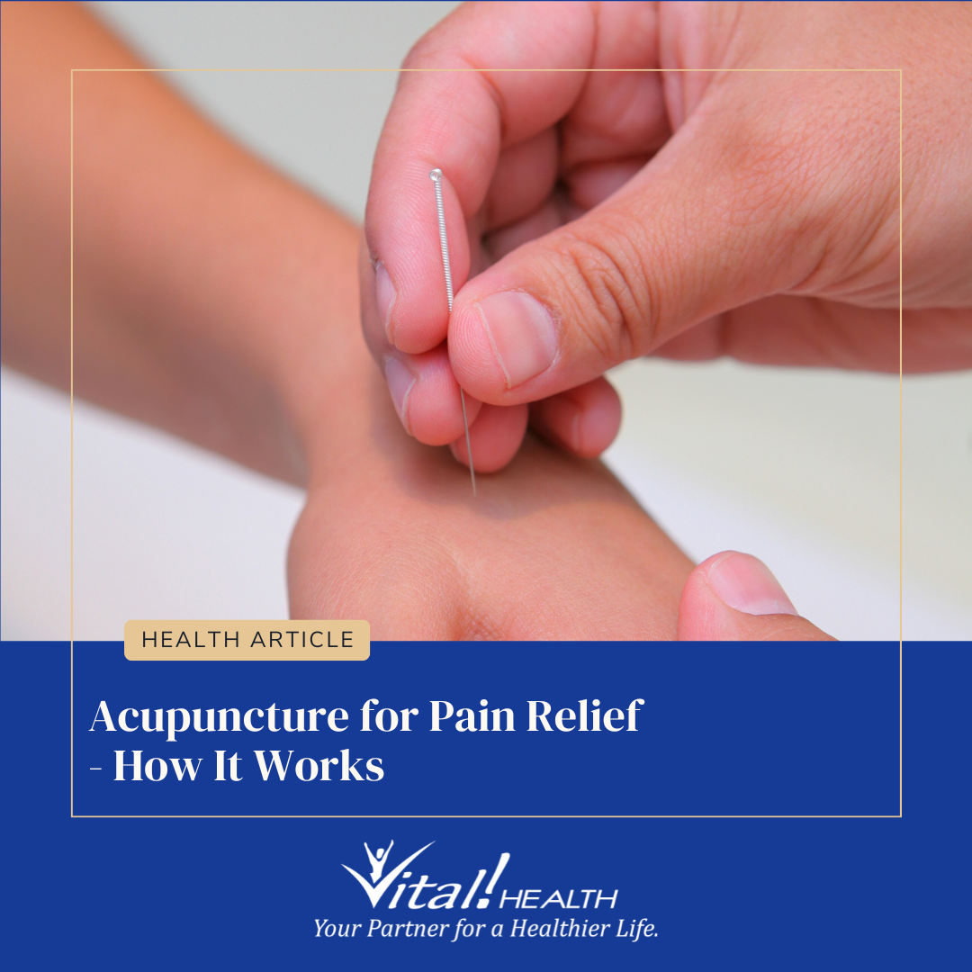 Acupuncture for Pain Relief – How It Works – Vital Health